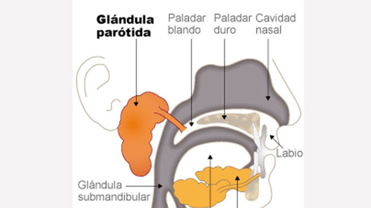 ¿Qué es el cáncer de glandulas parótidas que sufre Tito Vilanova?