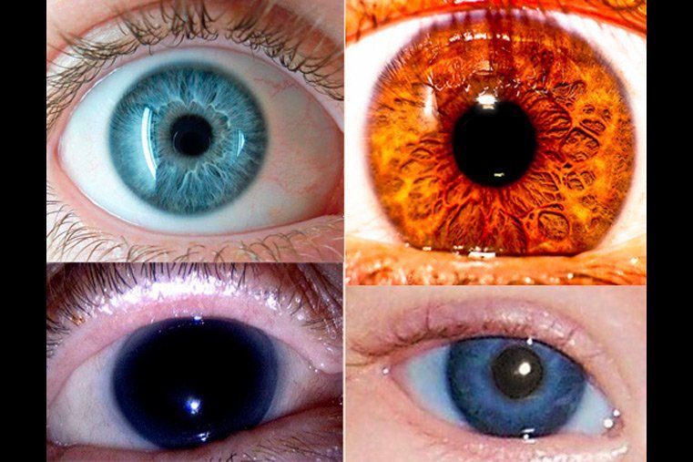 Los colores de ojos más raros en seres humanos