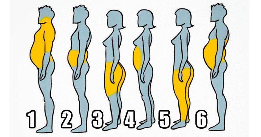 Son seis los tipos de obesidad: cómo combatirla en cada caso