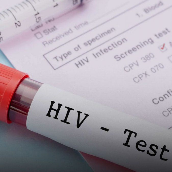 El SIDA no se transmite por vía sexual cuando la carga viral es indetectable