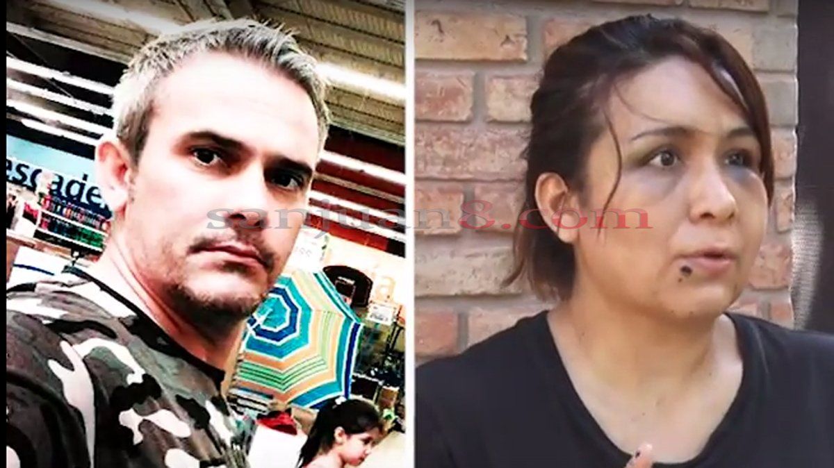 El conmovedor relato de la mujer atacada por su ex: Me dijo te vas a morir